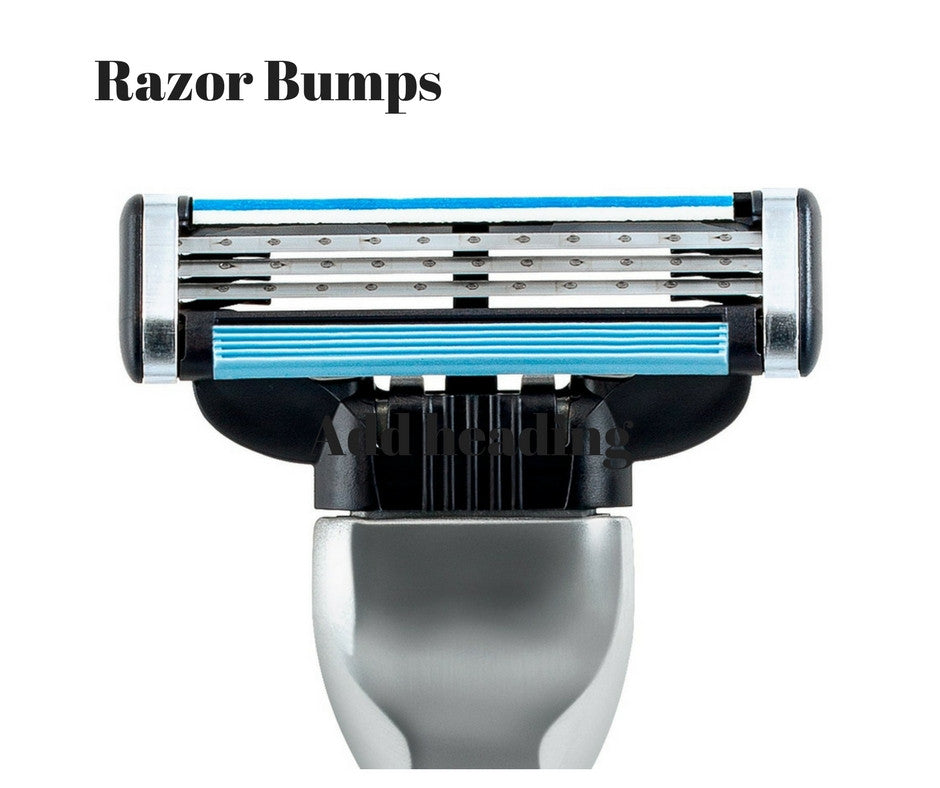 How to get rid of razor bumps and why you get them in the first place ...